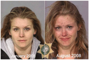 The Top 10 Worst Meth Transformations